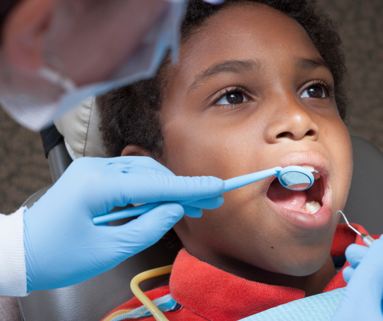 Cavities Happen—Here’s What to Do If Your Child Gets One – Fort Dental